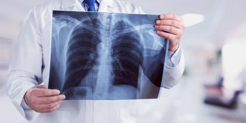 Hemoptiza (krv u iskašljaju) - bolesti i stanja | vasezdravlje.com