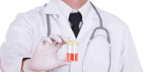 Akutna upala bubrega (akutni pijelonefritis) | vasezdravlje.com